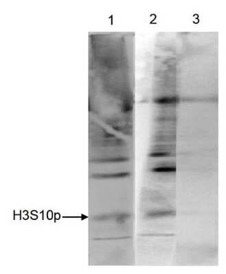 Histone H3 [p Ser10] Antibody (NBP2-59167): Novus Biologicals